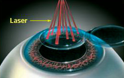 The Hong Kong Ophthalmic Associates